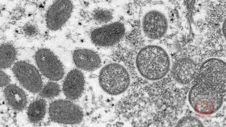 First Death from Alaskapox Virus in Alaska | Waradana