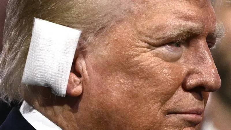 Trump Arrives at Republican Party Conference with Bandaged Ear Amid ...